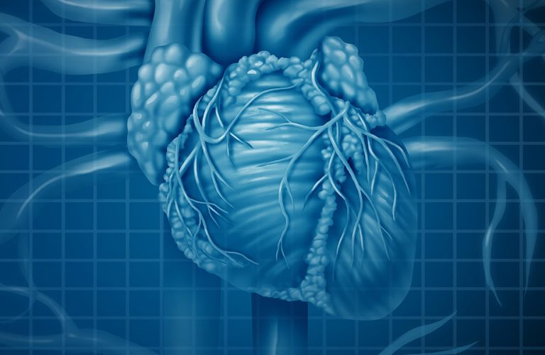 New Clinical Trial: JetStream, a Novel Device for Removing Lower ...